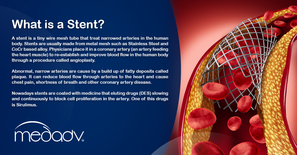 What is a Stent?